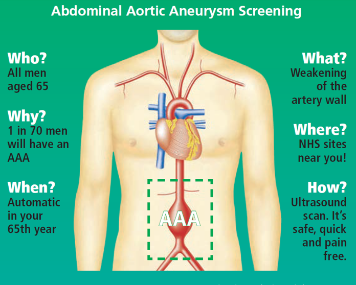 Abdominal Aortic Aneurysm Screening OurGateshead